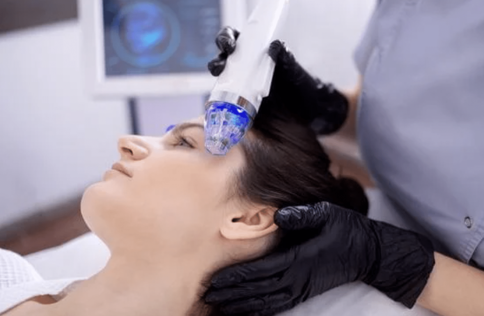 Understanding Microneedling with Radiofrequency: The Ultimate ...